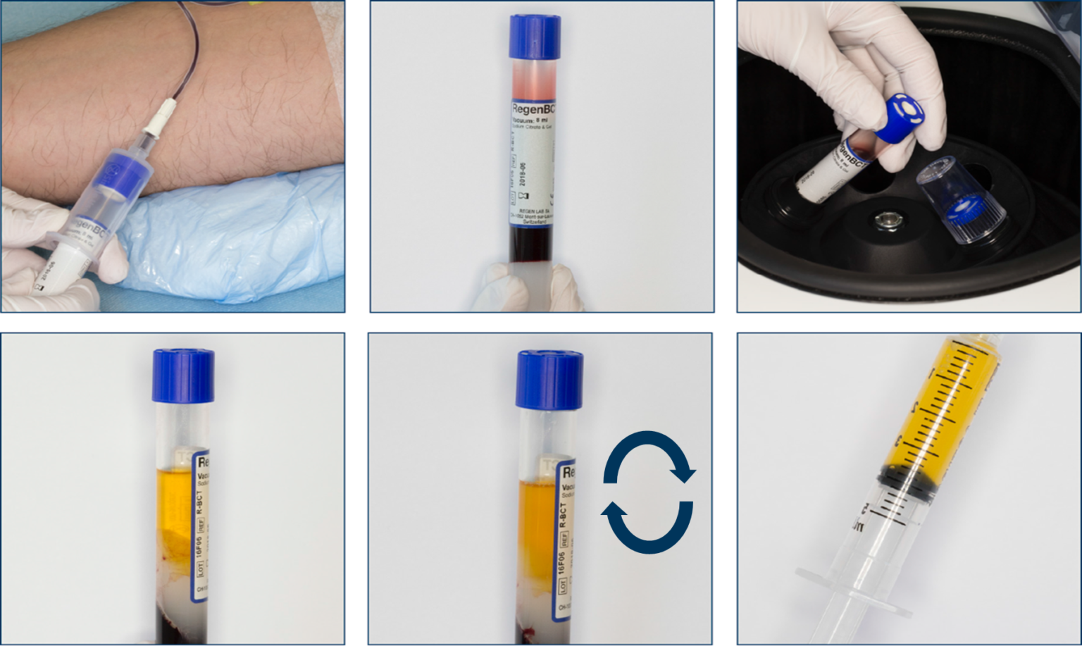 RegenBCT - RegenLab | PRP Supplier | PRP kits