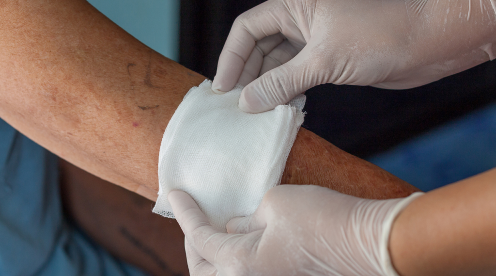 PRP for Wound Healing - RegenLab | PRP Supplier | PRP kits