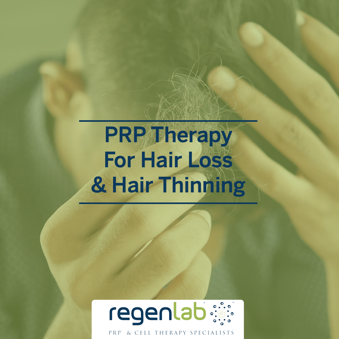 Hair loss treatment - RegenLab | PRP Supplier | PRP kits