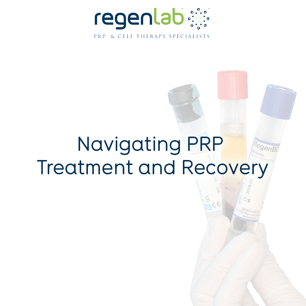 Navigating PRP Treatment and Recovery - RegenLab | PRP Supplier | PRP kits