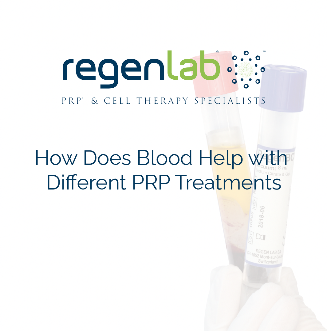 How Does Blood Help with Different PRP Treatments - RegenLab | PRP Supplier | PRP kits