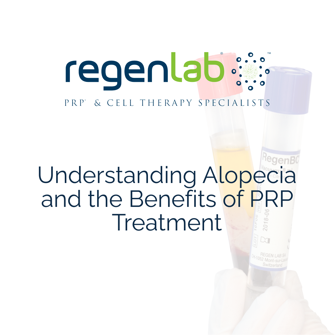 Understanding Alopecia and the Benefits of PRP Treatment - RegenLab | PRP Supplier | PRP kits